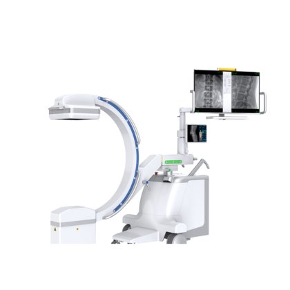 Medical Digital CArm Fluoroscopy Machine C Arm X Ray Machine in Chicago ...