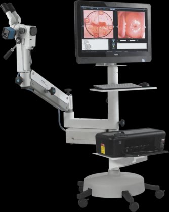 Obstetrics Gynecology Colposcope Digital Imaging System Gynecological ...