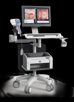 Obstetrics Gynecology Colposcope Digital Imaging System Gynecological ...