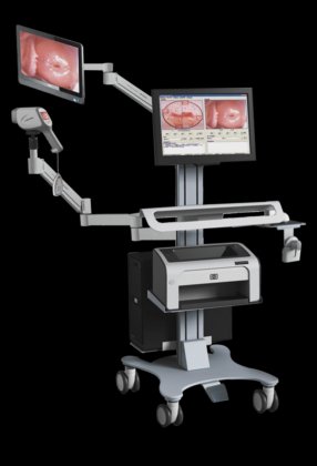 Obstetrics Gynecology Colposcope Digital Imaging System Gynecological ...