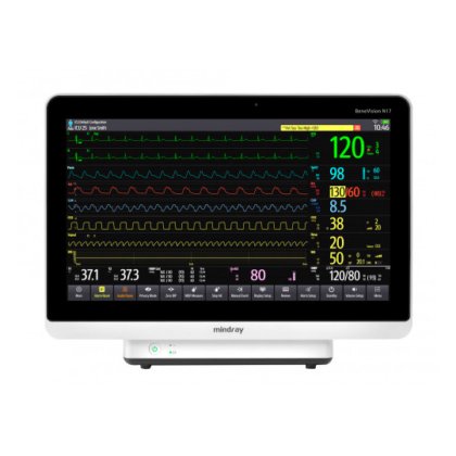 Mindray BeneVision N15 patient monitor in Moscow, Russia