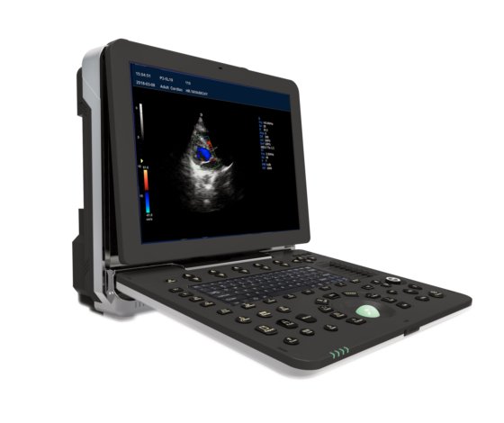 Dawei ultrasound machine color doppler ultrasound diagnostic system ...