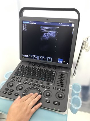 sonoscape 5d ultrasound machine physiotherapy ecografo portatil ...