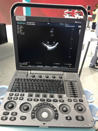 sonoscape 5d ultrasound machine physiotherapy ecografo portatil ...