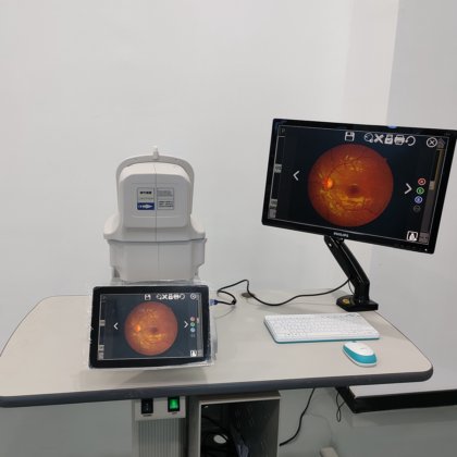 automatic fundus camera non-mydriatic retinal camera for fundus disease ...