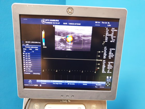 Gebraucht Ge Logiq P6 Bt11 View Mit 3sp Echosonde Und 9l Linear Sonde