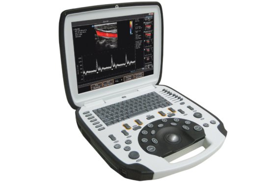 uSmart 3300 terason® digital ultrasound scanner in Cavaria, Lombardy, Italy