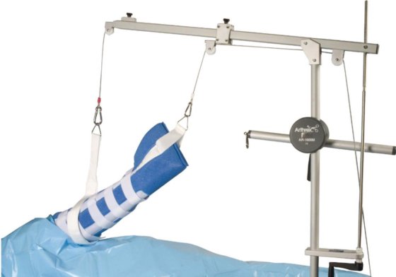 Arthrex 3-Point Shoulder Distraction System in Mokena, IL, USA