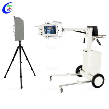 Intuitive Imaging: The 5.6KW Loadable DR X-Ray System with Touchscreen ...