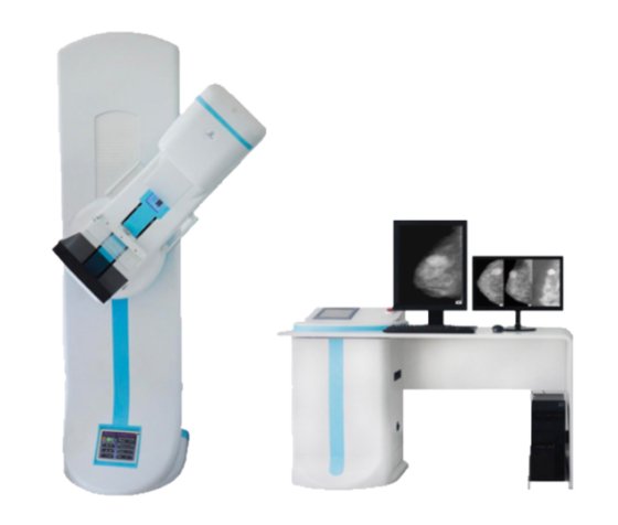 Full Field Digital Mammography System in Guangzhou, China