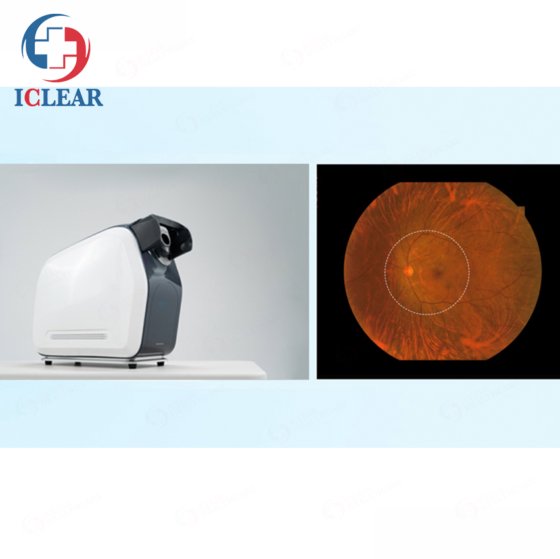 Direct IOP Four-stimuli Threshold Perimeter Visual Field Analyzer for ...