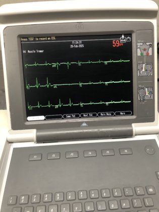 General Electric Medical Systems MAC 5000 in Big Lake, MN, USA