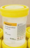 Used When Is Formalin Used for sale. Thermo Fisher Scientific equipment ...